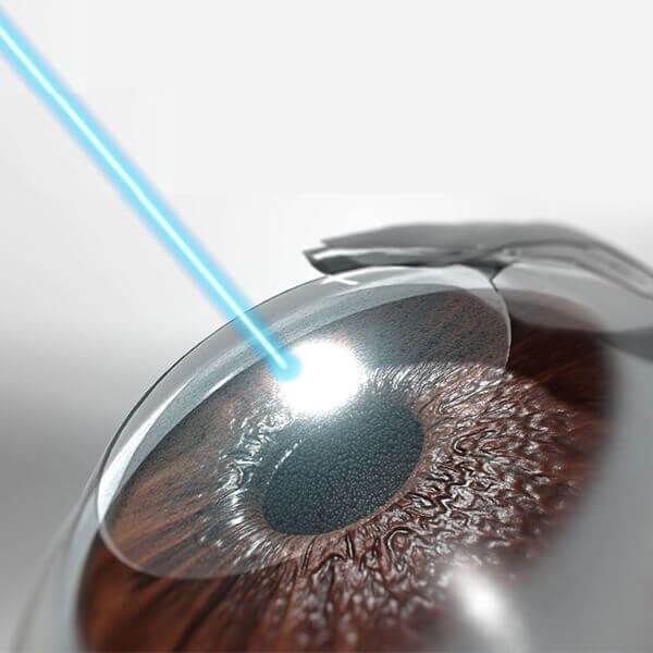 Age-Related Macular Degeneration - Dr. Harsh Inder Singh Retina Center